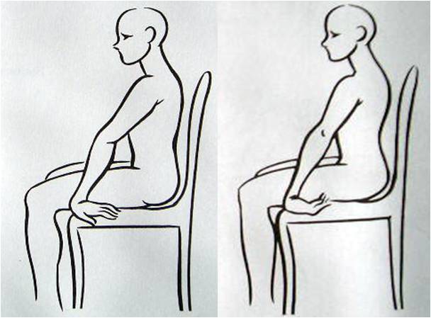 수근신근과 상완요골근hand Extensors Brachioradialis의 근막통증후군 네이버 블로그