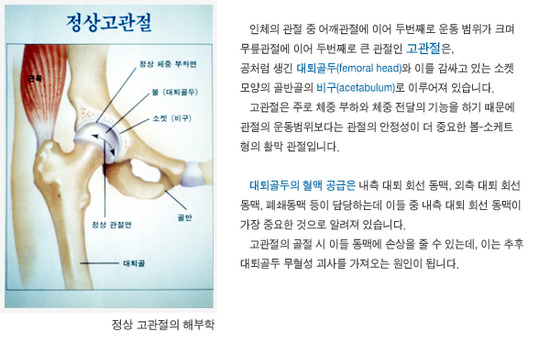 고관절 해부학 고관절질환 대퇴골두무혈성괴사의 진단법고관절대표 대퇴골두무혈성괴사의 원인 및 예방법 고관절인공관절수술 대퇴