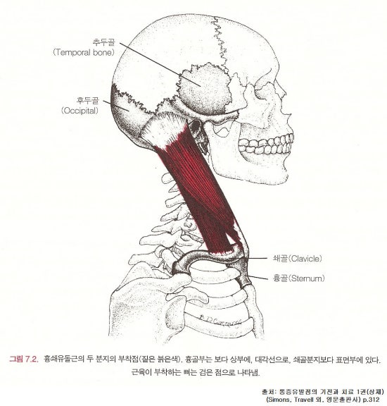 흉쇄유돌근 목빗근 Sternocleidomastoid Muscle Scm Muscle 래인보우한의원근육클리닉