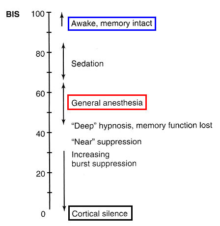 Bispectral Index (BIS) : 네이버 블로그