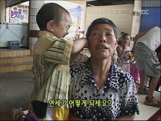 하이랜더 증후군highlander Syndrome 네이버 블로그