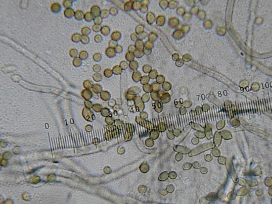 Cladosporium spp(클라도스포리움), Botrytis spp.(보트리티스, 잿빛곰팡이) : 네이버 블로그