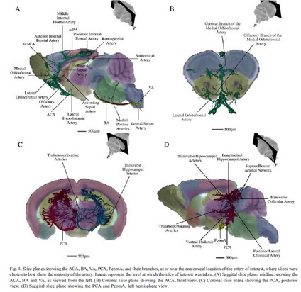 Blood vessel in mouse brain : 네이버 블로그