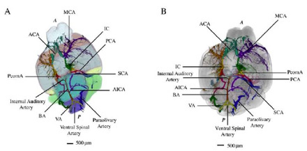 Blood vessel in mouse brain : 네이버 블로그