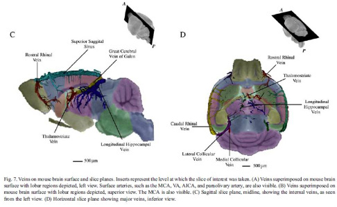 Blood vessel in mouse brain : 네이버 블로그