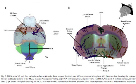 Blood vessel in mouse brain : 네이버 블로그