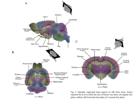 Blood vessel in mouse brain : 네이버 블로그