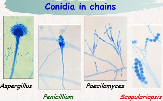 Mycology part1 (기본분류) : 네이버 블로그