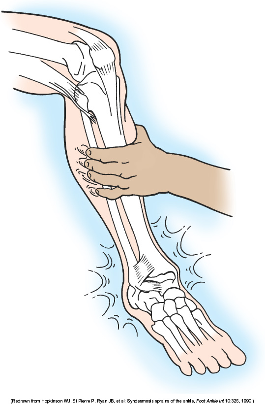 [Text] 족관절 급성 인대 손상 : Ankle Acute ligamentous Injuries by SungHun.Kim ...
