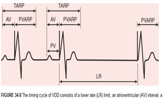 Pacemaker mode의 이해 (AAI, VVI, VDD, DDD) : 네이버 블로그
