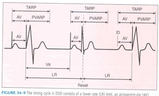 Pacemaker mode의 이해 (AAI, VVI, VDD, DDD) : 네이버 블로그