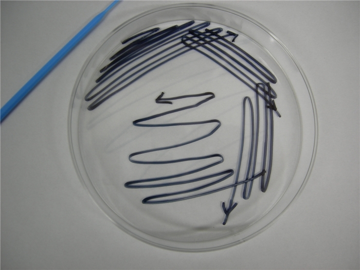 도말법 ( Streaking & Spreading ) : 네이버 블로그