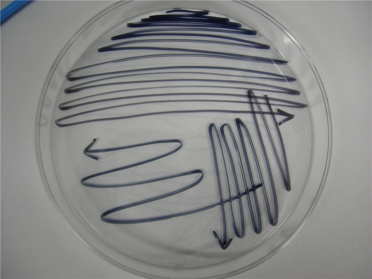 도말법 ( Streaking & Spreading ) : 네이버 블로그