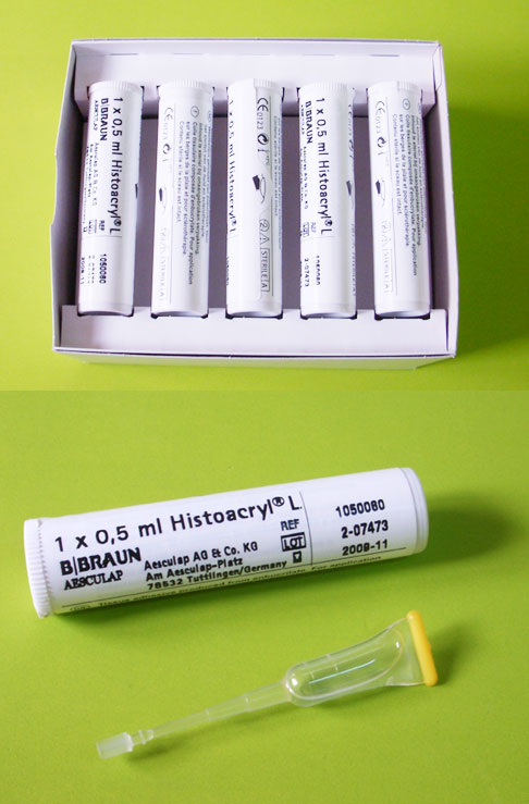 히스토아크릴 (HISTOACRYL)의 제품 기본정보 : 네이버 블로그