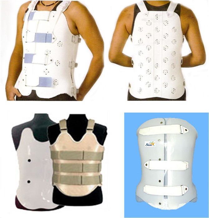 등,허리,엉치뼈 보조기,TLSO : 네이버 블로그