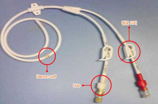 Hickman catheter (히크만카테터) : 네이버 블로그