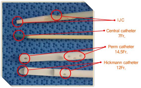 펌카테터와 내경정맥카테터 (Perm cath & IJC) : 네이버 블로그