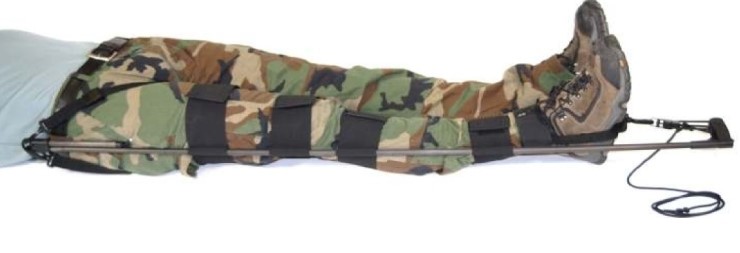 Traction splint ( Thomas splint 넓다리뼈 당김부목, 대퇴골 견인부목) : 네이버 블로그