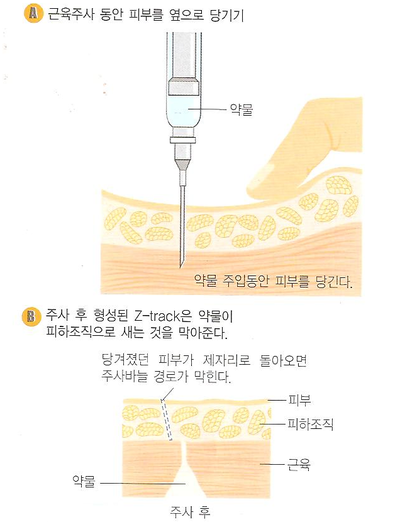 투약간호비경구투여 피내피하근육정맥idscimivintradermal Injection Subcutaneous