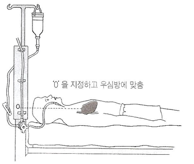 CVP(central venous pressure) 중심정맥압측정 : 네이버 블로그