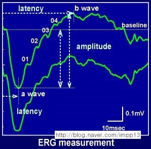 시각유발전위 - ERG, Electro Retinogram, 망막전위도 : 네이버 블로그