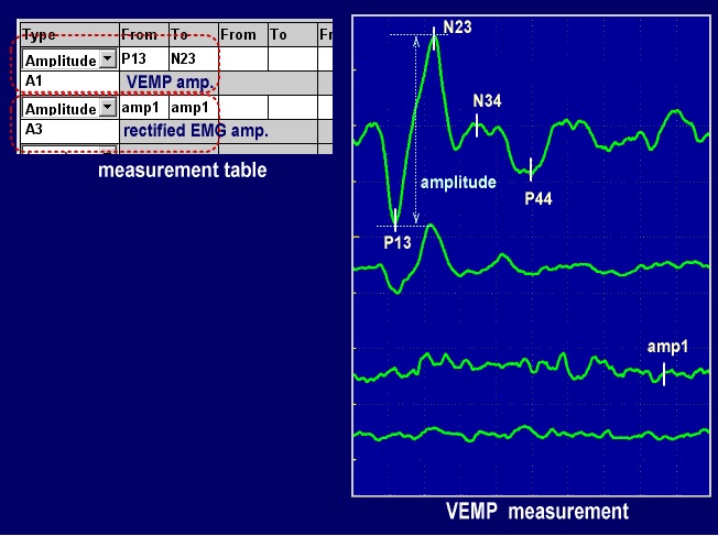 청각유발전위 - 전정유발근전위, VEMP, Vestibular Evoked Myogenic Potential : 네이버 블로그