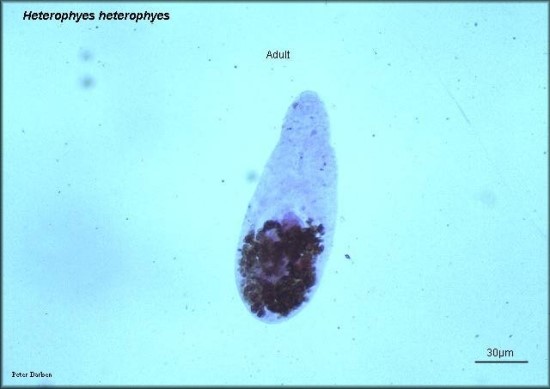 이형흡충과(Heterophyidae),이형이형흡충(Heterophyes heterophyes) : 네이버 블로그