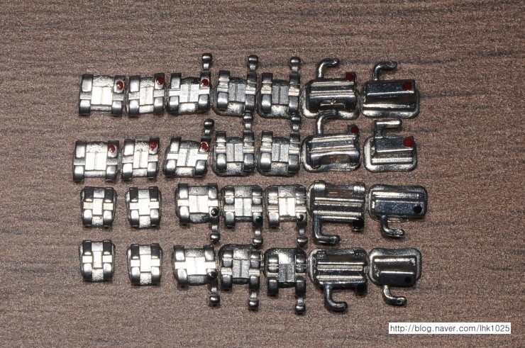 Roth vs MBT prescription의 비교 - 3m Gemini metal bracket을 이용한 분석 : 네이버 블로그