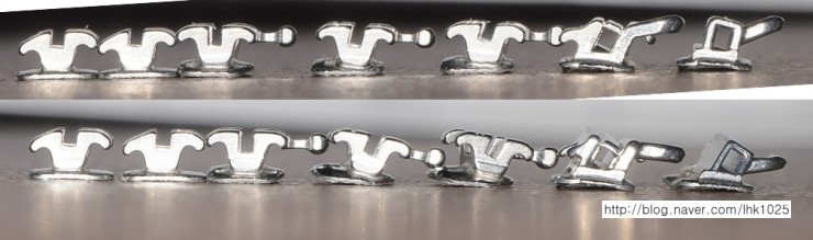 Roth vs MBT prescription의 비교 - 3m Gemini metal bracket을 이용한 분석 : 네이버 블로그