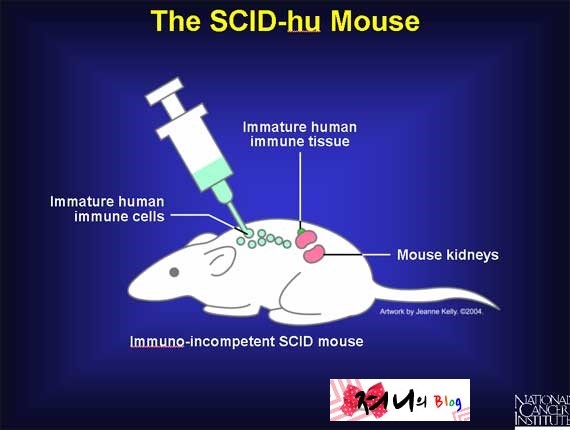 [져니] SCID-hu mouse란? : 네이버 블로그