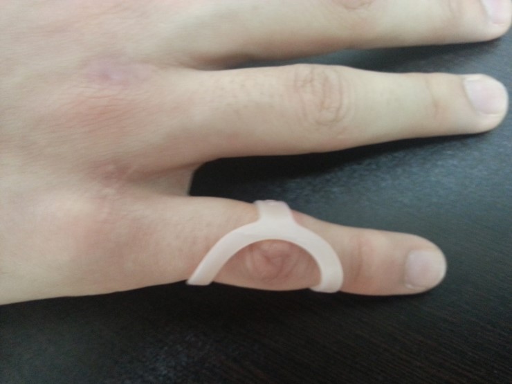 손가락 측부 인대 손상 /Collateral Ligament Disruption - finger / 3pp Buddy Loops ...