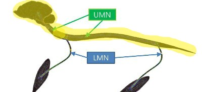 신경해부생리(5) - UMN(상위운동신경원, upper motor neuron), LMN(하위운동신경원, lower motor ...