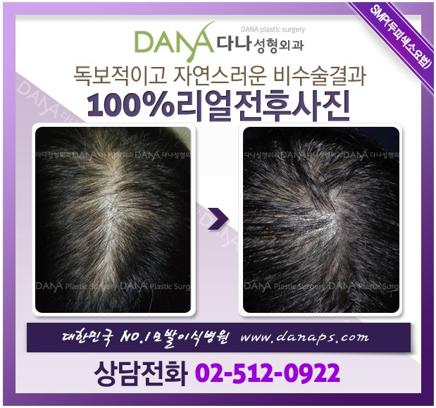 [smp/dmp]dmp와 smp의 차이점 : 네이버 블로그