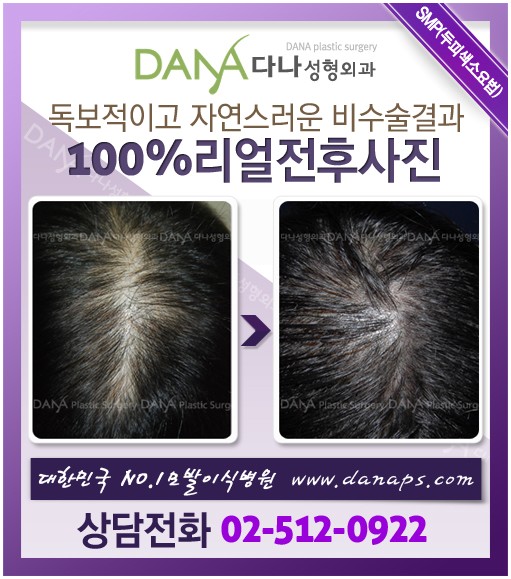 [smp/dmp]dmp와 smp의 차이점 : 네이버 블로그