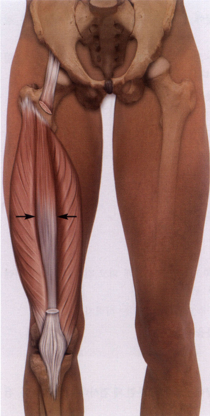 넙다리대퇴의 근육 3 Vastus Intermedius 중간넓은근 중간광근中間廣筋 네이버 블로그
