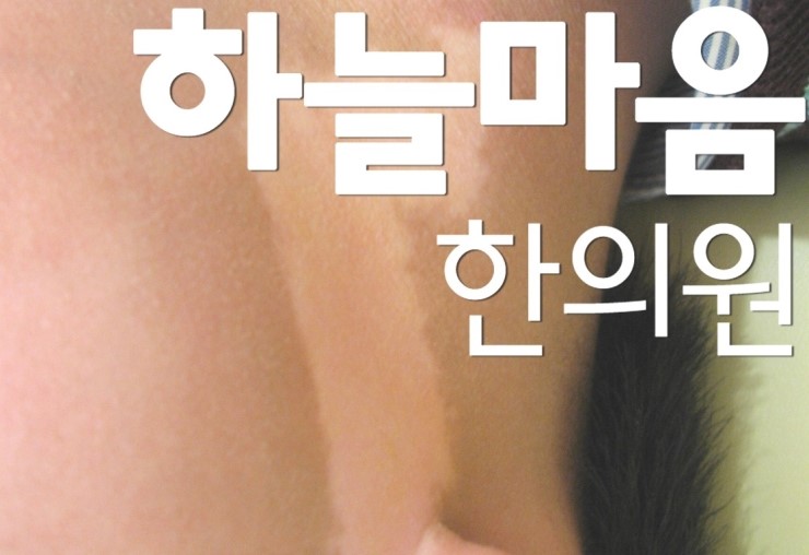 백반증 치료 백반증 초기증상 → 치료하쟈 네이버 블로그