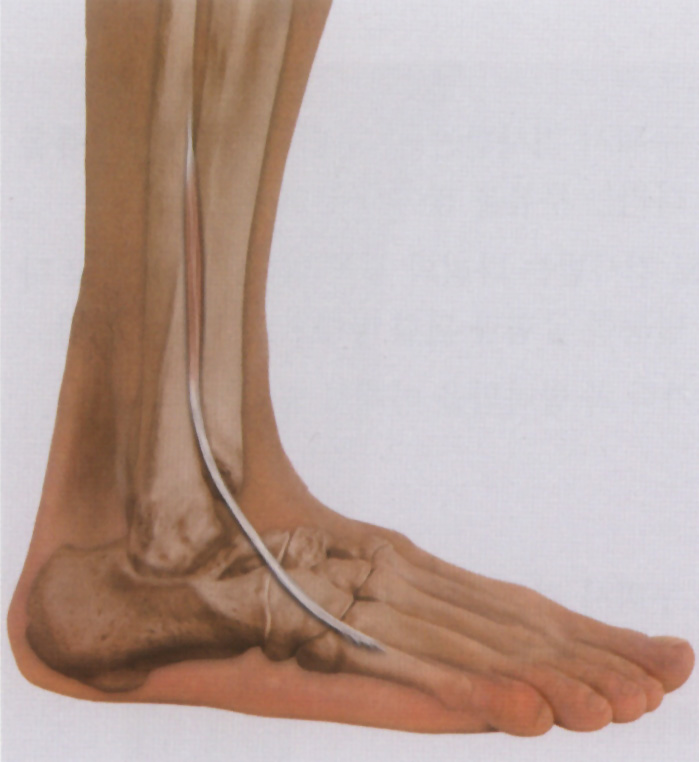 종아리(하퇴)의 근육 04 - Peroneus tertius, Fibularis tertius 셋째종아리근 제삼비골근 第三腓骨筋 ...