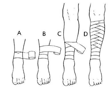 [기본간호] 상처간호5, 상처소독법, 붕대법(Circular(환행법),Spiral(나선법),Spiral-reverse(나선절전법 ...