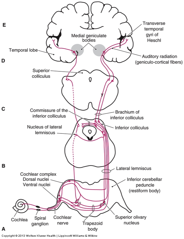 후미로성 난청 (Retrocochlear hearing loss) : 네이버 블로그