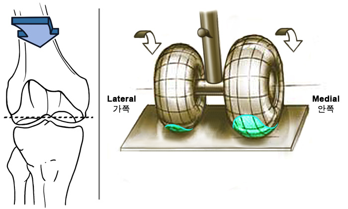 Screw-home (나사잠김) 매커니즘에 관하여.. : 네이버 블로그