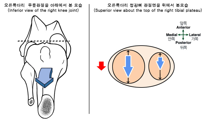 Screw-home (나사잠김) 매커니즘에 관하여.. : 네이버 블로그