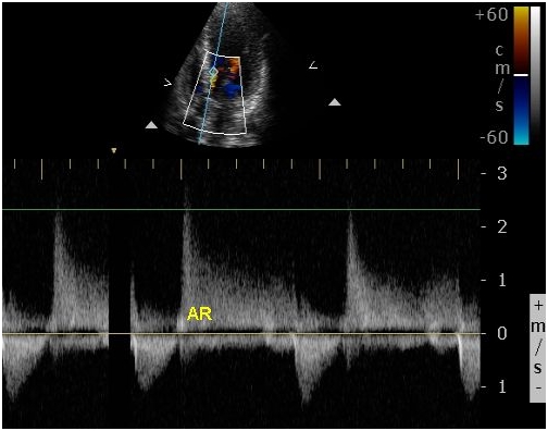 Trivial regurgitation : 네이버 블로그