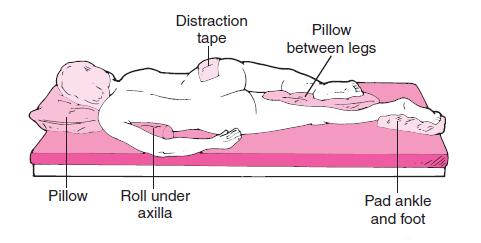 fowler position : 네이버 블로그
