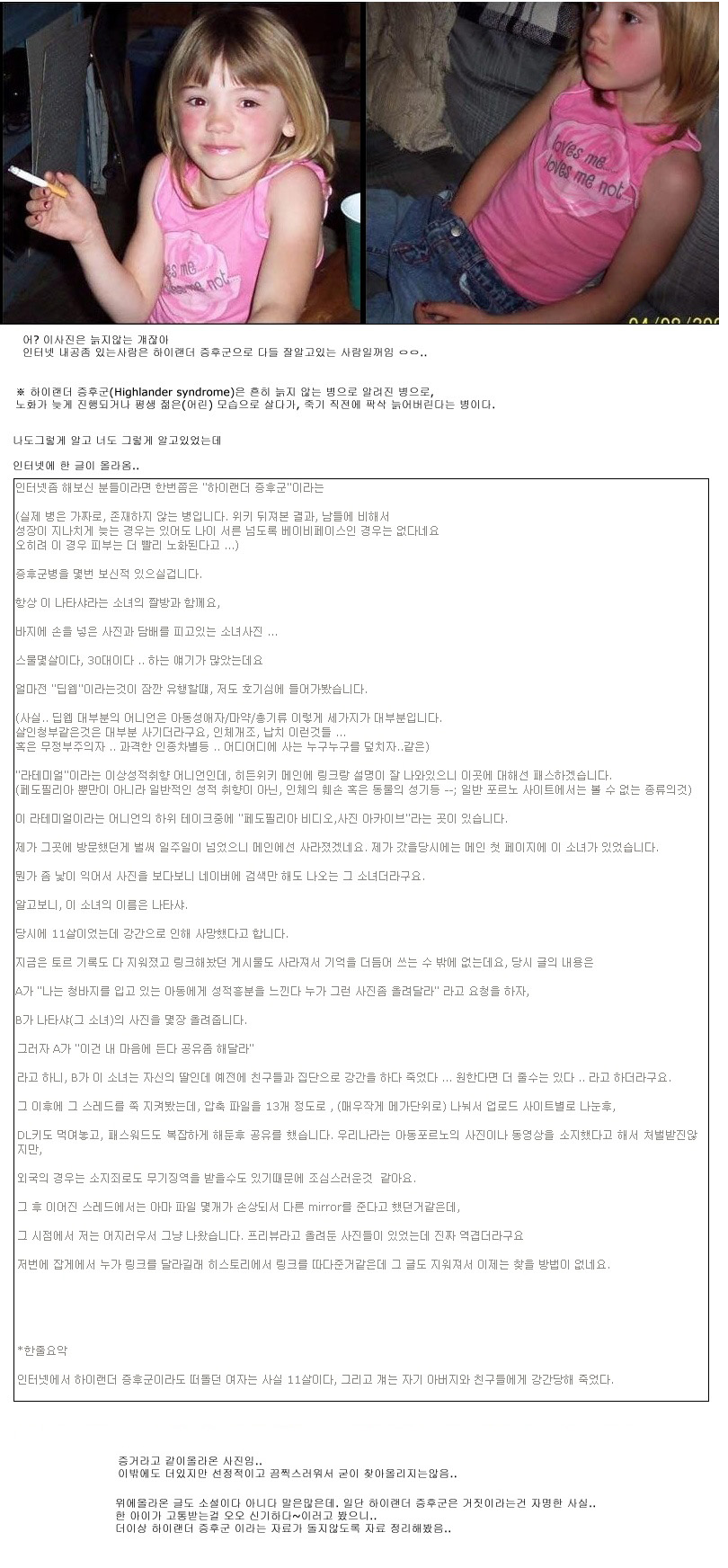 하이랜더 증후군의 진실 하이랜더 증후군에 걸렸다는 소녀 사진의 진실 네이버 블로그 9716