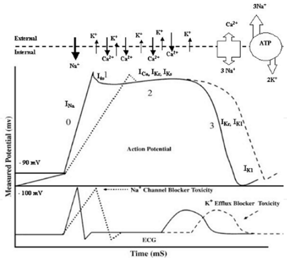 TCA overdose, ECG : 네이버 블로그