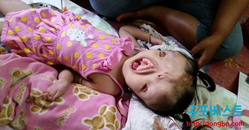 [혐] 정말 안타깝게 태어난 아이. : 네이버 블로그