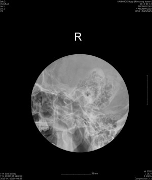 방사선 촬영법 (방사선검사메뉴얼) : 네이버 블로그