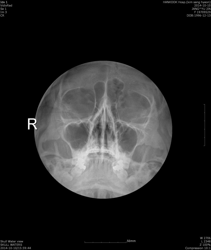 방사선 촬영법 (방사선검사메뉴얼) : 네이버 블로그