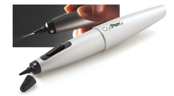 무마취로 수술가능한 크라이오펜(cryopen) : 네이버 블로그