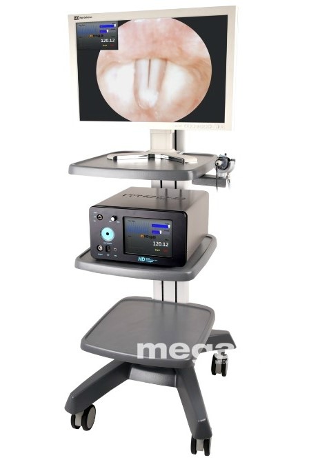 스트로보스코피, 성대 검사 장비 보이스닥터 (stroboscopy) : 네이버 블로그